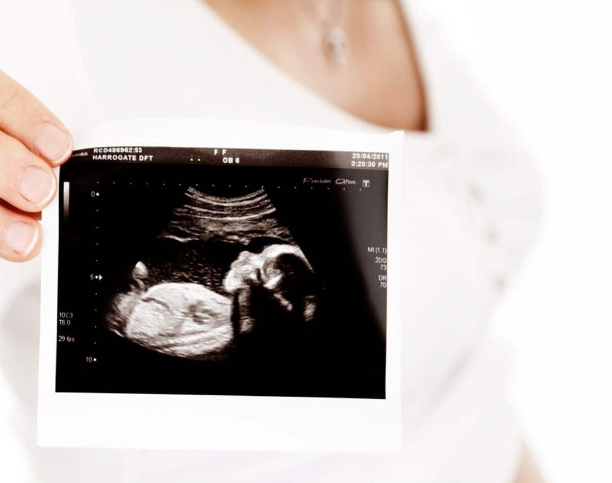 La banalización de la vida del “nasciturus” - Aceprensa